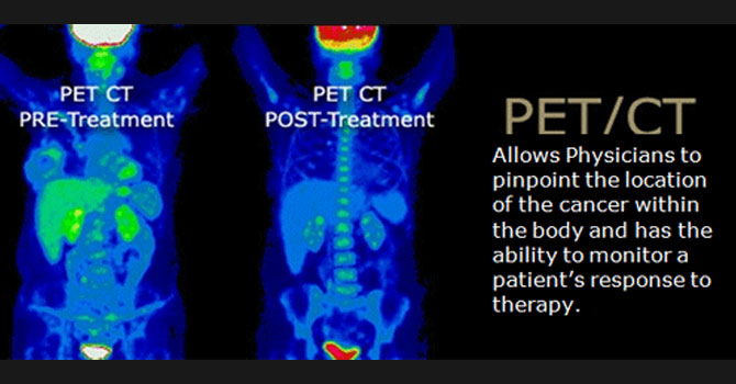pet10 | SRMS FIMC Lucknow | Radiodiagnosis in Lucknow