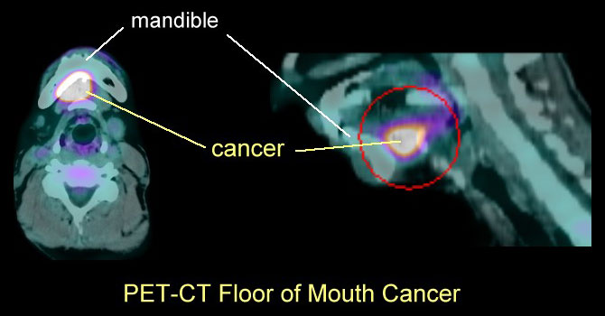 Best PET-CT Scan Centre in Lucknow, UP | Nuclear Medicine