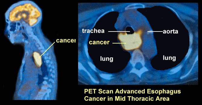 Best PET-CT Scan Centre in Lucknow, UP | Nuclear Medicine